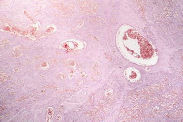 145 Capillary Under Microscope Stock Photos - Free & Royalty-Free Stock ...