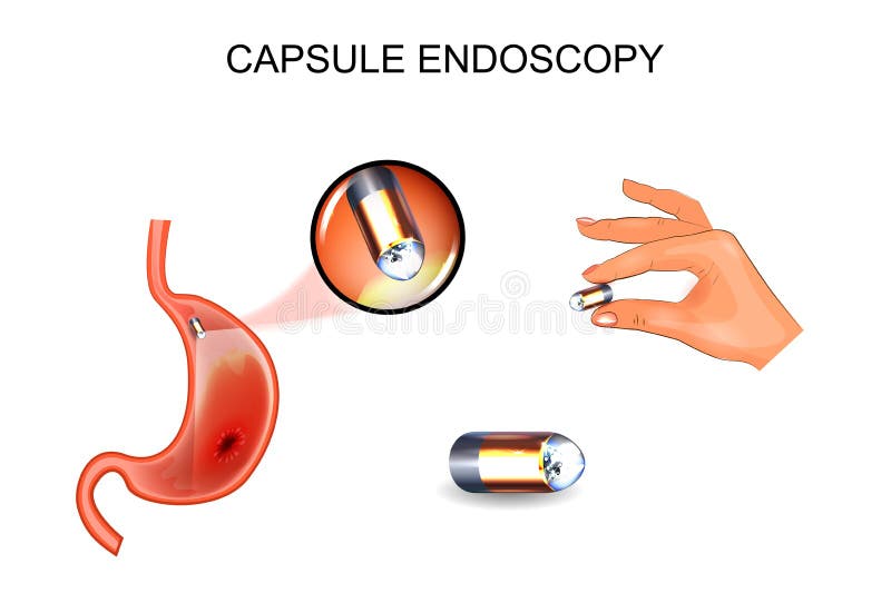 Gastroenterology Stock Illustrations – 5,790 Gastroenterology Stock ...