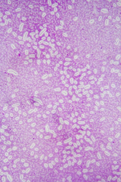 Capsule Stain of Bacillus Bacteria Stock Image - Image of research ...