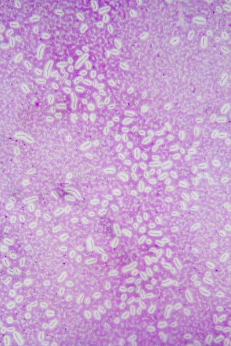 Capsule Stain of Bacillus Bacteria Stock Image - Image of research ...