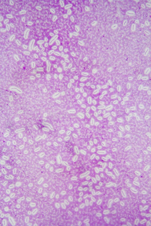 Capsule Stain of Bacillus Bacteria Stock Image - Image of research ...