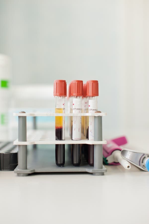 Capsules for the Blood Analysis Stock Image - Image of test, health ...