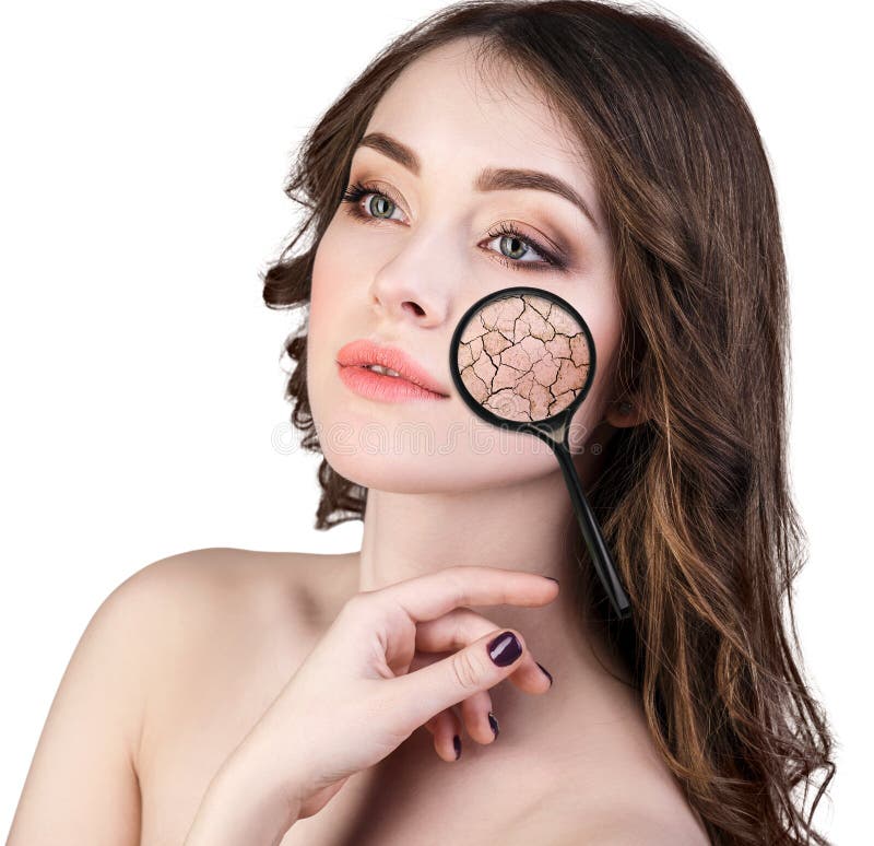 Cara De La Mujer Joven Con La Piel Seca Foto de archivo - Imagen de ...