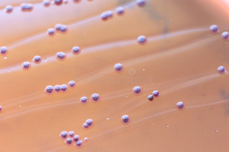 E Escherichia Coli En Agar De EMB Imagen de archivo - Imagen de humano ...