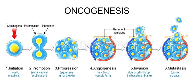 Carcinogenesis. Oncogenesis Stages. Cancer Development Stock Vector ...