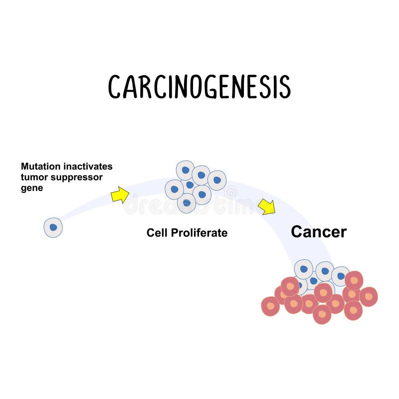 Carcinogenesis: the Process of Cancer Development, Involving Genetic ...