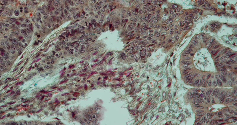 Large Intestine of Human Being in Section Magnified Under Microscope in ...