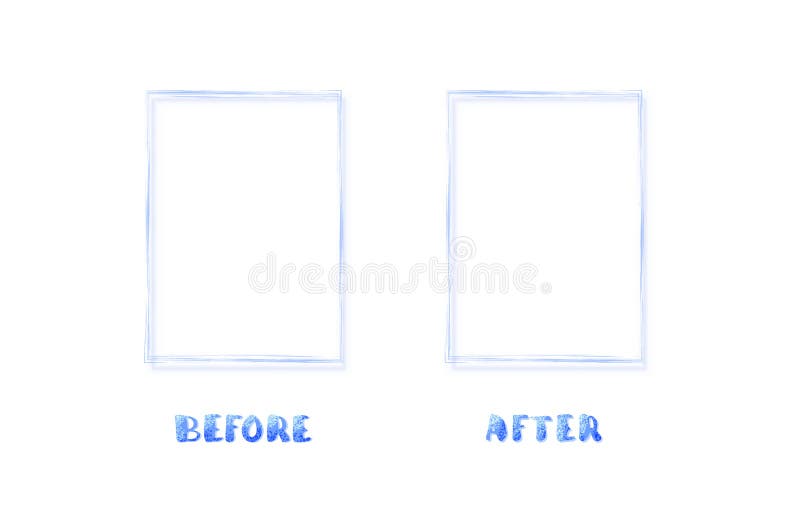Before and after Card. Vector Illustration. Stock Vector - Illustration ...