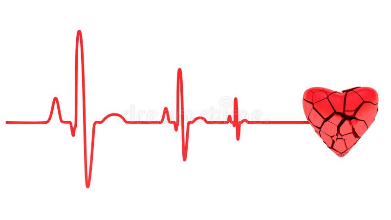 Cardiac arrest, ECG stock illustration. Illustration of line - 38241340