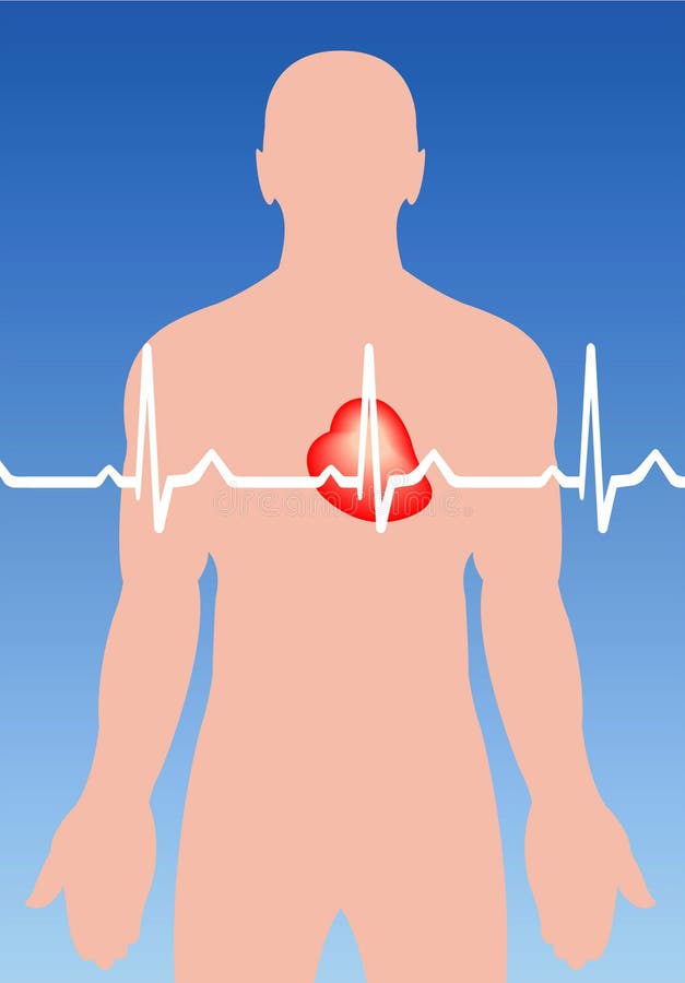 Cardiac arrhythmia stock vector. Illustration of slow - 18864765