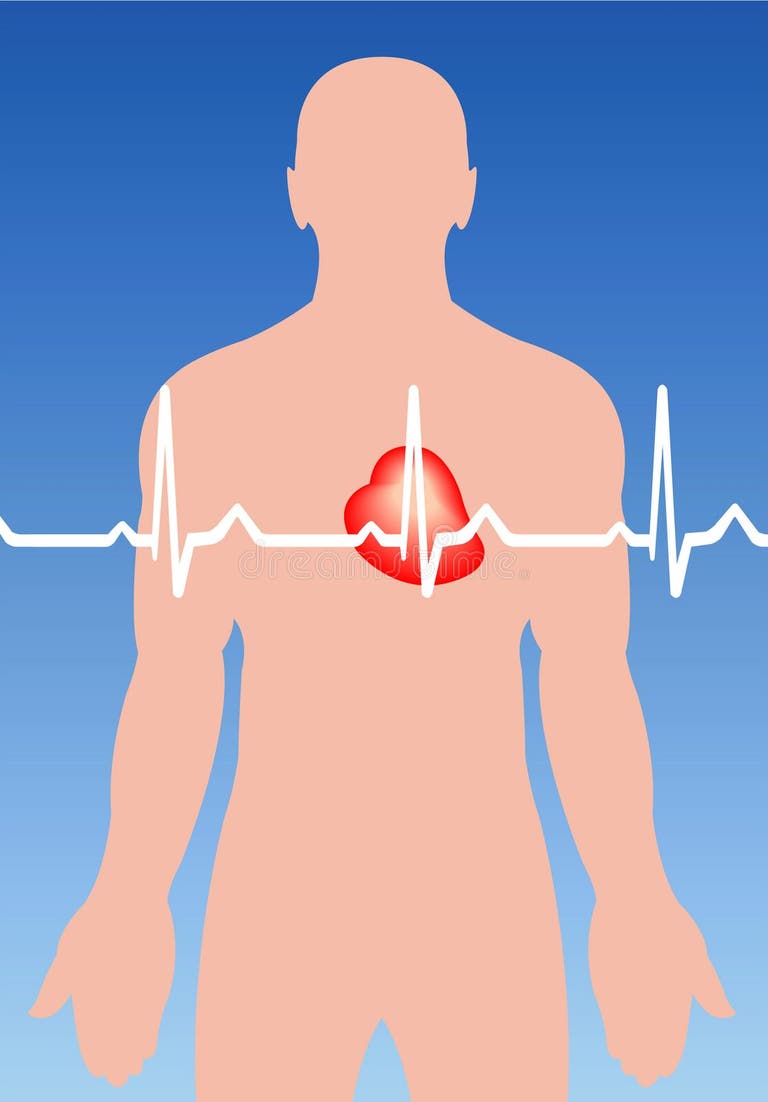 Cardiac Pacemaker Stock Illustrations – 1,284 Cardiac Pacemaker Stock ...