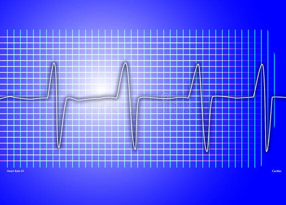Cardiac Graph Blue Stock Illustrations – 2,227 Cardiac Graph Blue Stock ...