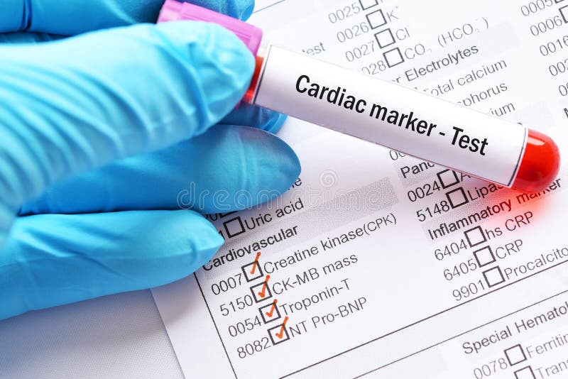 Cardiac marker test stock photo. Image of disease, hospital - 113662138