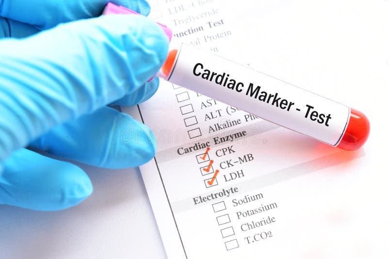 Cardiac marker test stock image. Image of patient, biology - 64248031