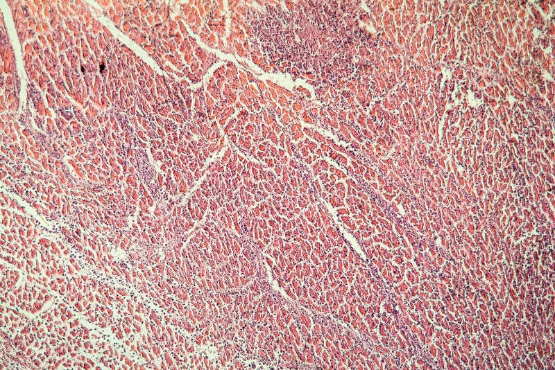 Cardiac Muscle 100x