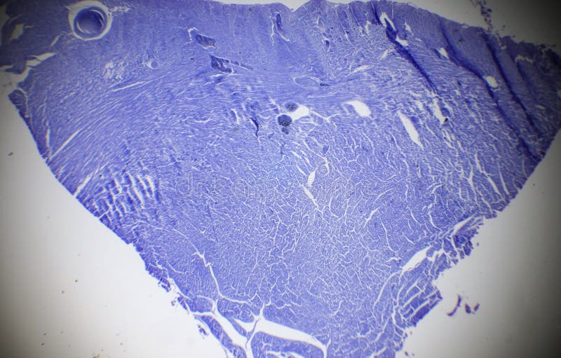 Cardiac Muscle Section Under the Microscope Stock Image - Image of ...