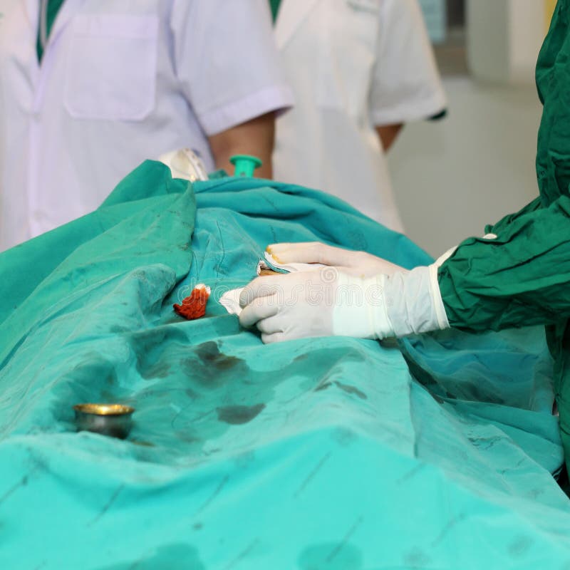 Cardiac Surgery Operation Team Stock Image - Image of practice ...
