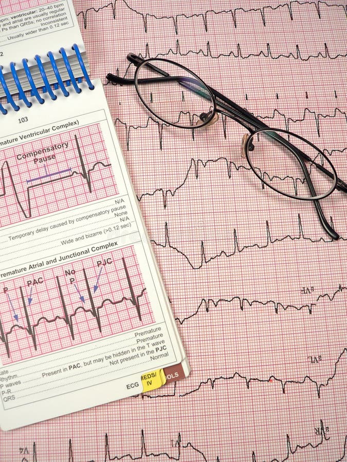 Cardiaco imagen de archivo. Imagen de cardiaco, pulso - 1791051