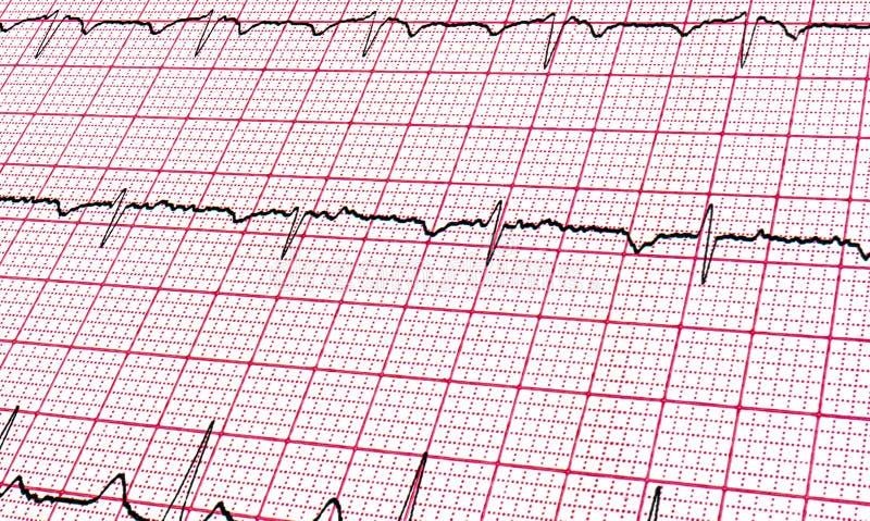 Cardio, cardiogramm, stock image. Image of body, doctor - 72446949