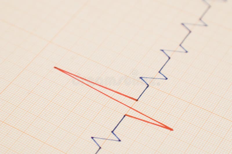 Cardio Graph stock photo. Image of illness, health, care - 4127780