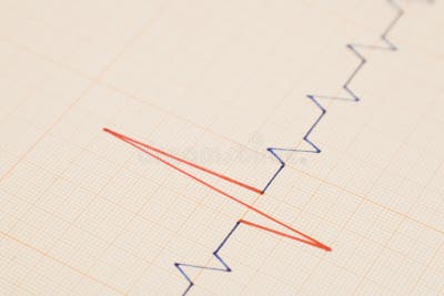 Cardio Graph stock photo. Image of illness, health, care - 4127780