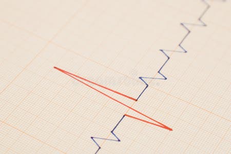 Cardio Graph stock photo. Image of illness, health, care - 4127780