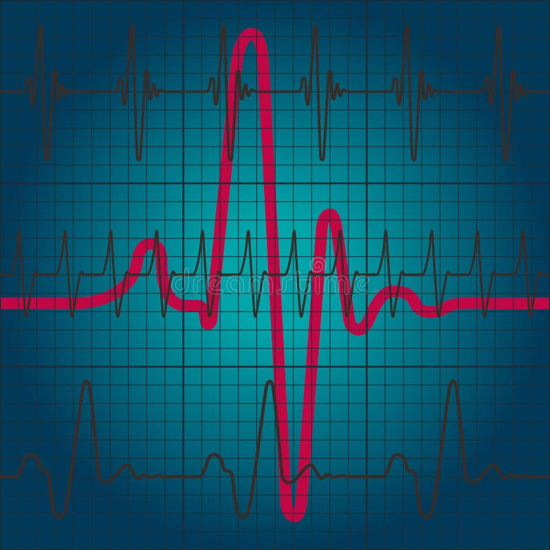 Cardiogram stock vector. Illustration of heartbeat, illness - 13034276