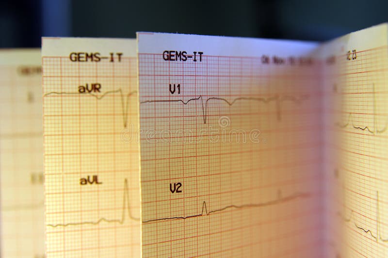 Cardiogram stock photo. Image of examination, report - 17085592