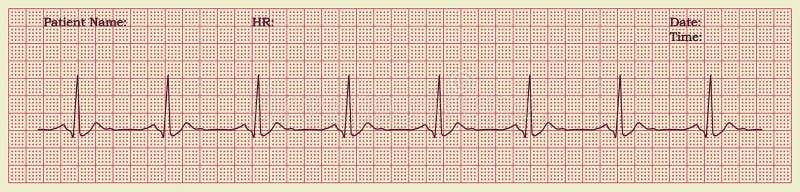 Cardiogram stock vector. Illustration of paper, heart - 25633781