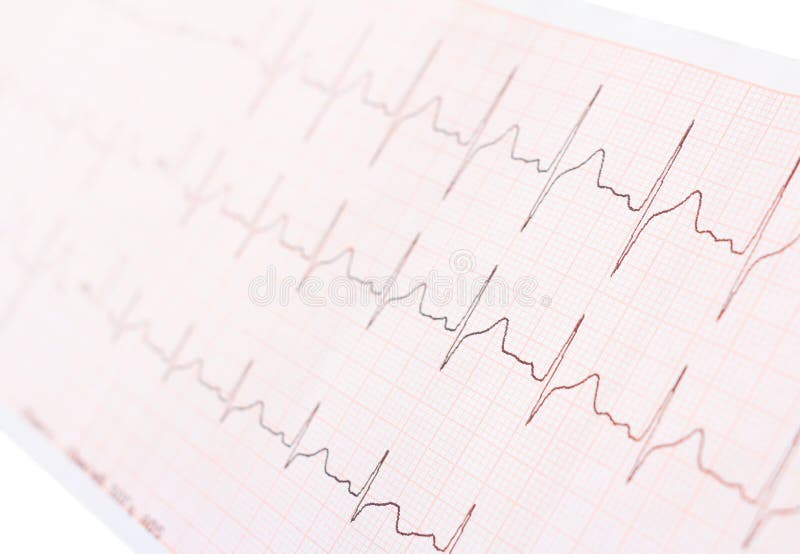 Cardiogram stock image. Image of graph, medicine, electrocardiograph ...