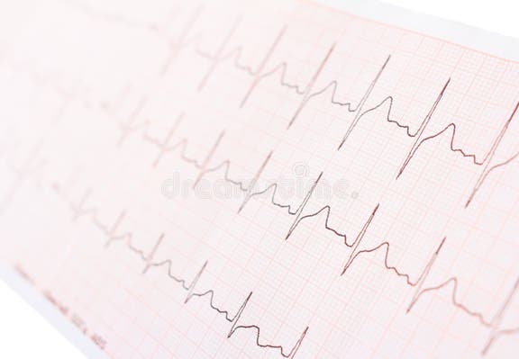 Cardiogram stock image. Image of graph, medicine, electrocardiograph ...