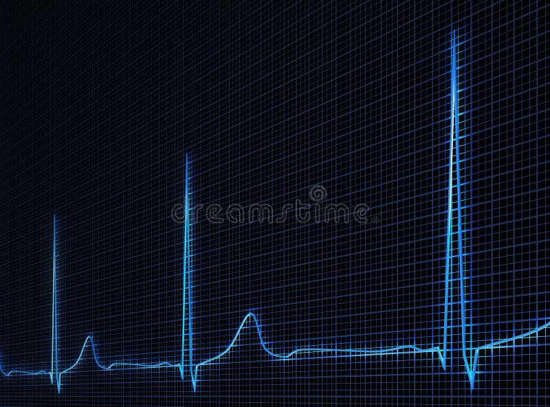 Blue cardiogram stock vector. Illustration of medical - 7408665