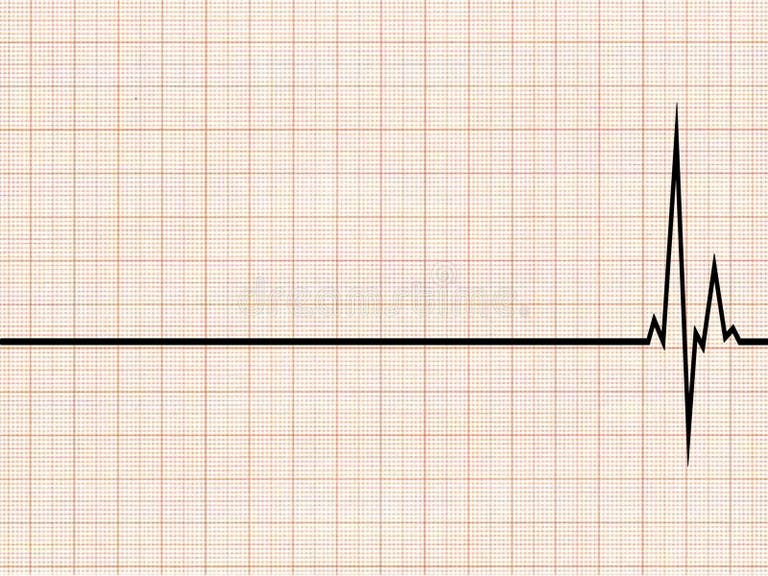 Cardiogram Flatline Stock Illustrations – 43 Cardiogram Flatline Stock Illustrations, Vectors ...
