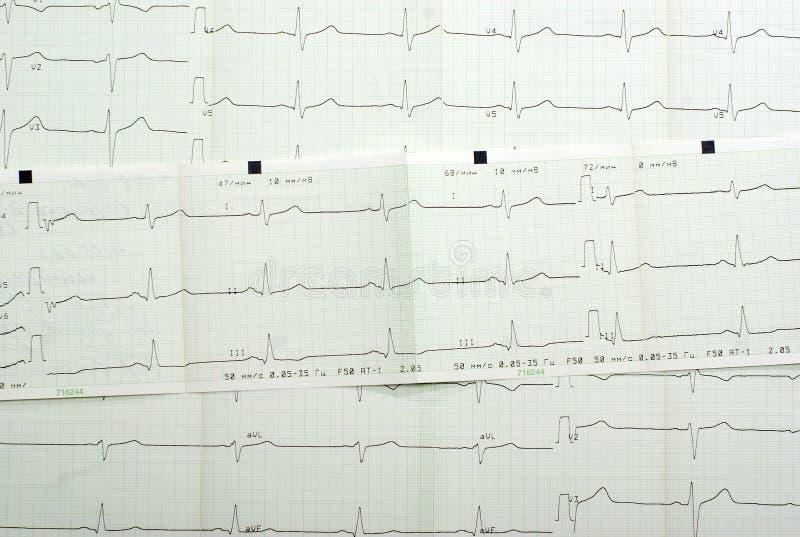 Cardiogram Background Picture. Image: 4277654