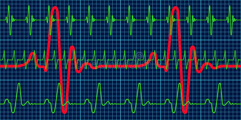 Cardio Charts Stock Illustrations – 40 Cardio Charts Stock ...