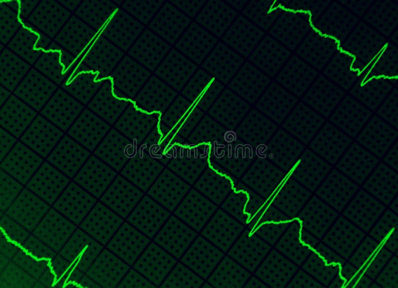 Cardiogram EKG with the Heartbeat Stock Illustration - Illustration of ...