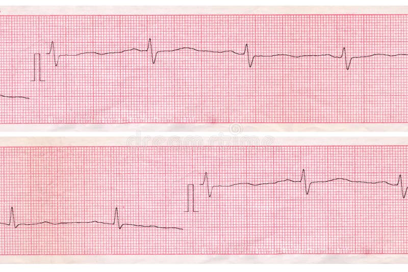 Cardiogram. Heart Analysis Scheme Stock Image - Image of test ...