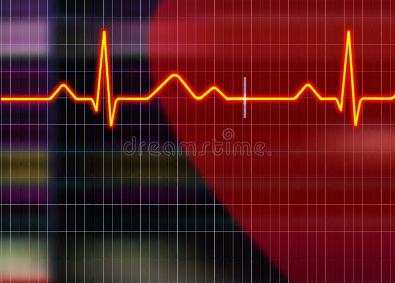 Cardiogram Illustration Picture Image 5497324