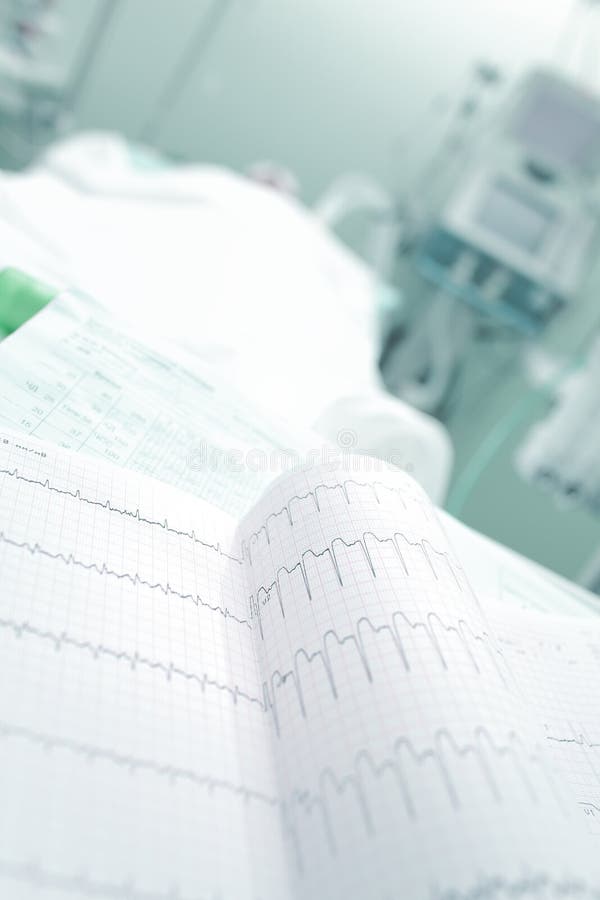 Heart Attack In The ICU. ECG Of Heavy Patient Stock Image - Image of ...