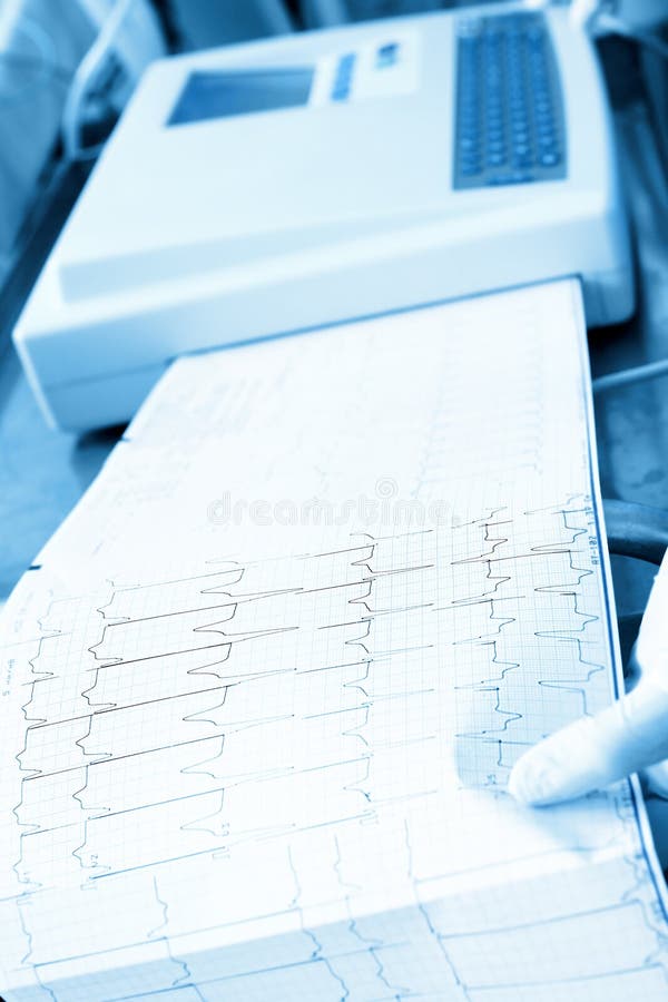 Cardiogram recording stock image. Image of computer, paper - 45640263