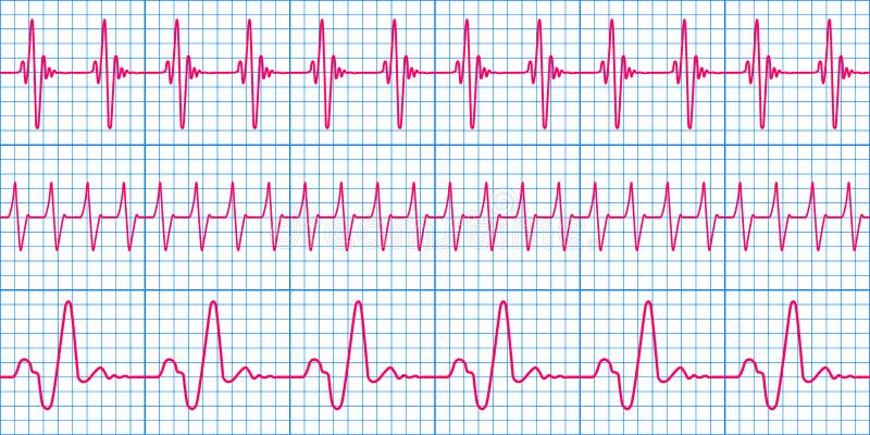 Cardiogram stock vector. Illustration of heartbeat, care - 13338365