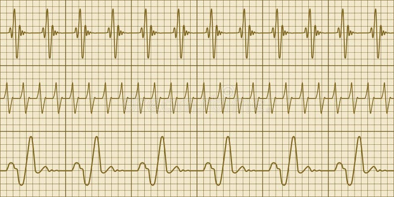 Cardiogram stock vector. Illustration of screen, hospital - 51724377