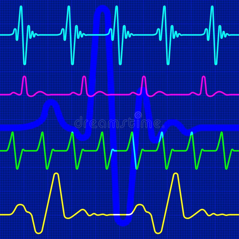 Cardiogram Stock Vector Illustration Of Amplitude Monitor 35734353
