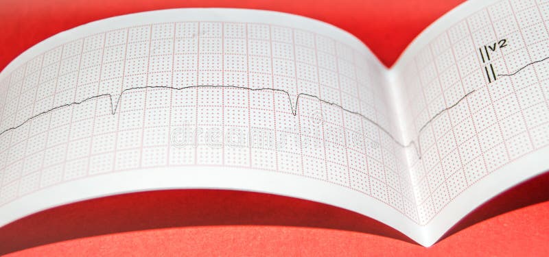 EKG Tape Electrocardiograph (with Clipping Path) Stock Photo - Image of ...