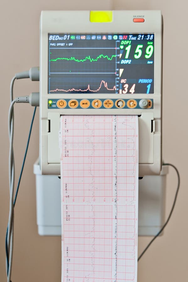 Cardiogram Test Ekg Heart Pulse Results Stock Photo - Image of analyse ...
