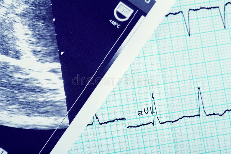 Fetus and Electrocardiogram Test Stock Photo - Image of body, birth ...