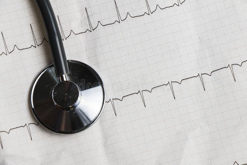 Cardiogram, Waves of Heart Beat, EKG on the Paper Stock Image - Image ...