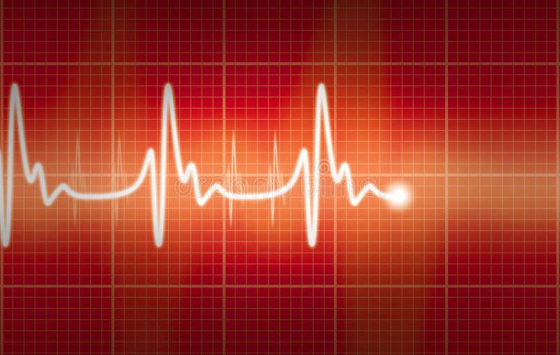 Cardiograma imagen de archivo. Imagen de electrocardiograma - 17809531