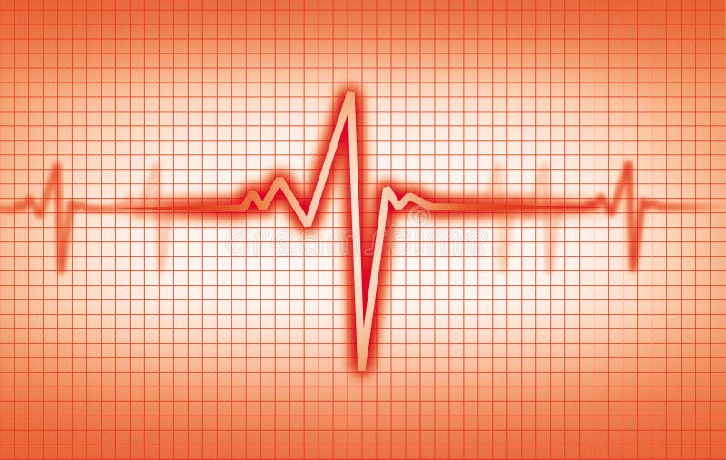 Cardiograma imagen de archivo. Imagen de electrocardiograma - 17809531
