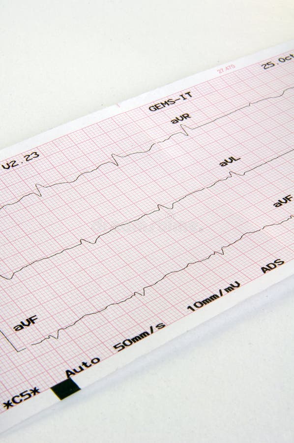 Cardiograma foto de archivo. Imagen de médico, medicina - 17085400